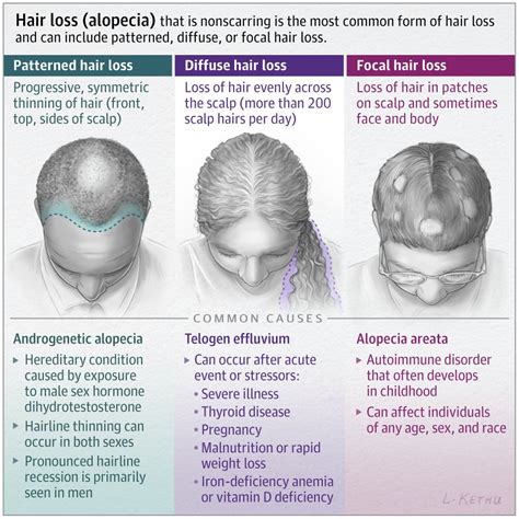 Hair Follicles Hair Loss