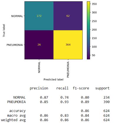 Github Krishvraman Pneumonia Classification Chest X Rays