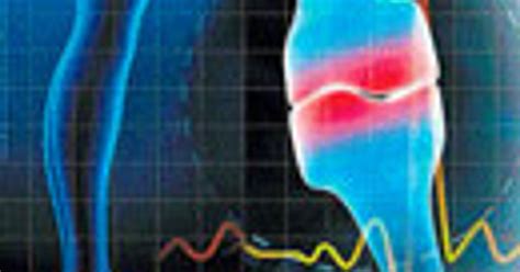 Molecule That Regenerates Damaged Cartilage