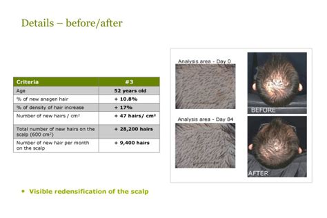 Details Before And After