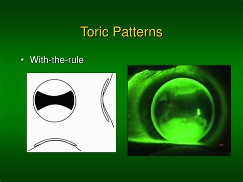 Ppt Fluorescein Patterns Powerpoint Presentation Id 510009