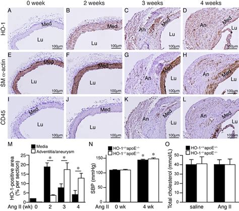 Heme Oxygenase 1 Deficiency Exacerbates Angiotensin Ii Induced Aortic
