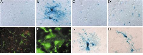 Transduction Of Primary Cultured Cns Cells A E Cocultures Of Rat Download Scientific Diagram