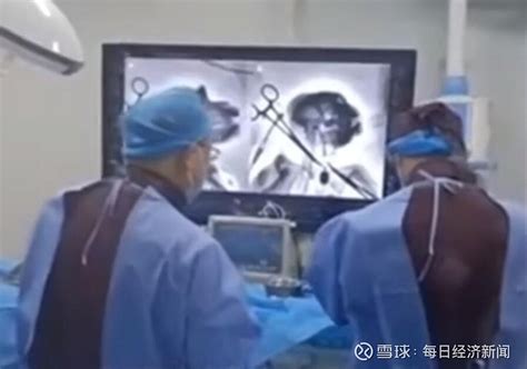 走和马斯克不同的路 国产脑机接口是如何实现意念控制机械臂的 用大脑意念操作机械臂一项颇为赛博朋克的试验已在国内落地 5月4日全球