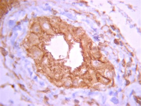 Anti Pp2a Antibody Catalytic Subunit 07 1216