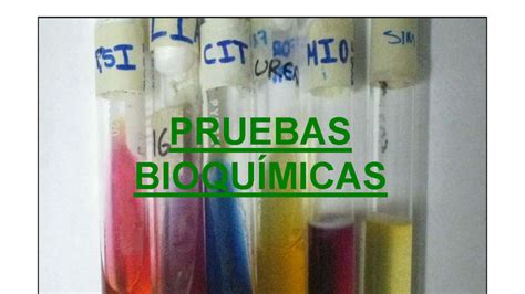 Pruebas Bioquímicas De Identificación Microbiana 39871143 Studocu