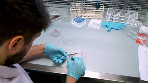 Intestinal Crypts Isolation A Method To Isolate Whole Crypts From