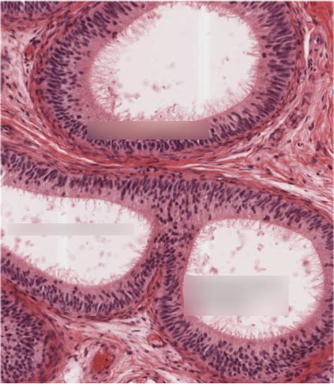 L10 Epididymis Histology B Diagram Quizlet