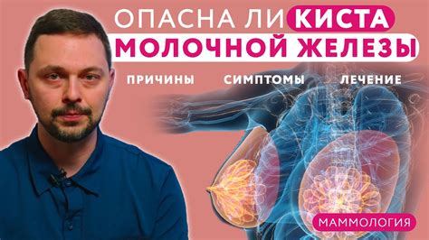 👩 Киста молочной железы причины диагностика симптомы и лечение