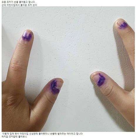 상처 난 아이 손에 스탬프 잉크 칠한 어린이집 유머움짤이슈 에펨코리아