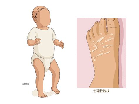 新生儿 医学插画