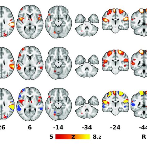 Areas Associated With Sustained Pressure Stimulation The Red Yellow Download Scientific