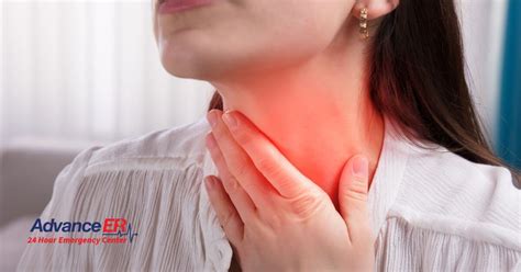 What Does Strep Throat Look Like