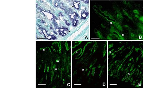 Gastric Mucosa Of T A Aaa Lectin Strongly Labelled The Apical Download Scientific Diagram