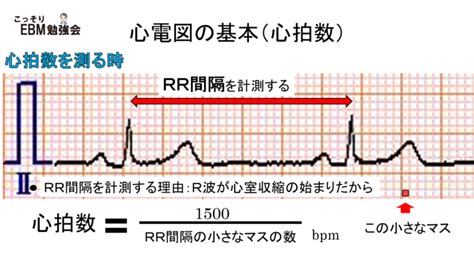 心電図の基礎（心拍数） こっそりebm勉強会