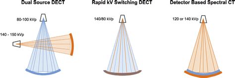Illustration Of The Three Major Dual Energy Ct Dect Techniques