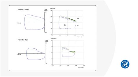 Journal Club Manual Compression Of Abdomen To Assess Expiratory Flow Limitation Hamilton Medical