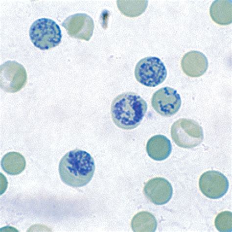 Reticulocyte Stain Labchem Catalog