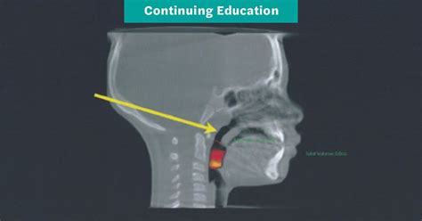 Orthodontic Practice Us Dental Continuing Education Resources On Linkedin Orthodontics Ce