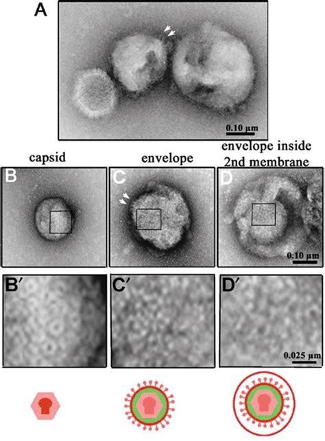 Electron Microscopy Shows Enveloped Hsv Inside A Second Membrane A