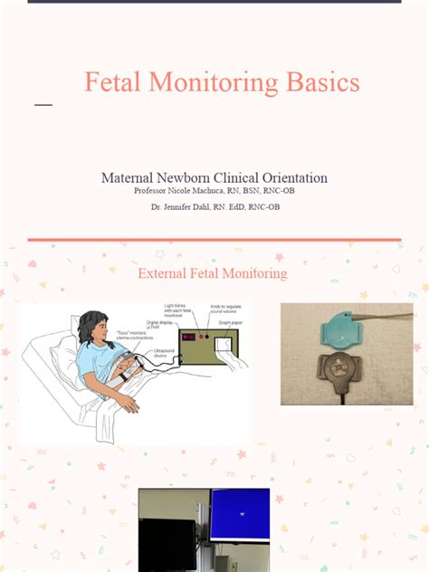Basic Fetal Monitoring Pdf