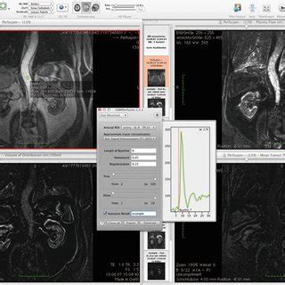 Example Of The Result Of The Deconvolution Model Implemented In Download Scientific Diagram