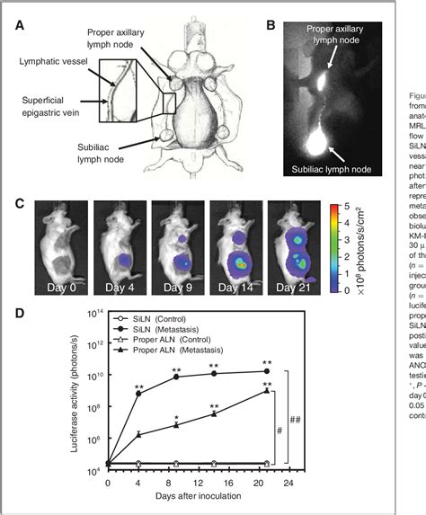 Figure 1 From Enhanced Sonographic Imaging To Diagnose Lymph Node