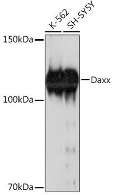 Anti Daxx 항체 Assay Genie