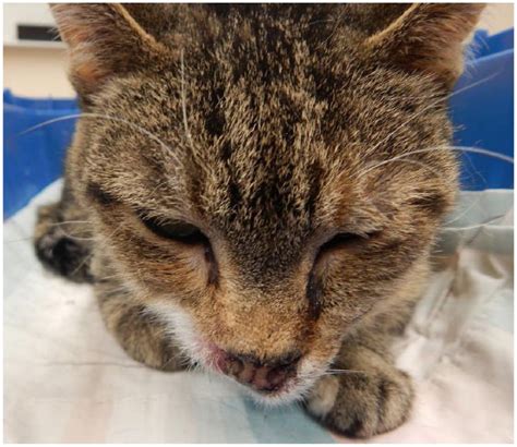 Cutaneous Squamous Cell Carcinoma Manifesting As Follicular Isthmus