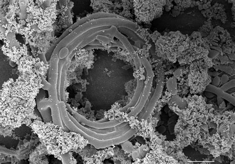 Trichoderma In Private Fungig Fungi And Genes