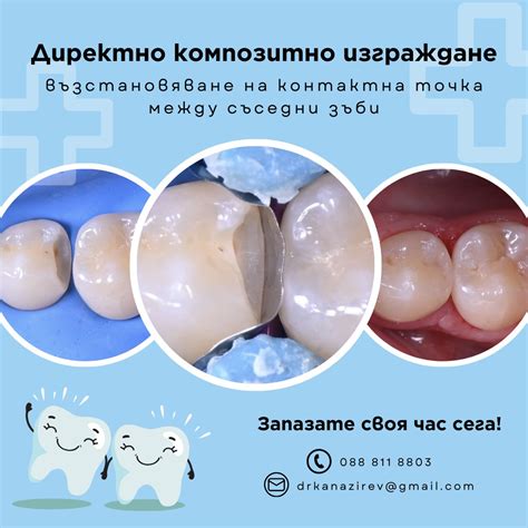 K Clinic 🧐 Правилно изграждане на контактна точка или защо детайлите имат значение