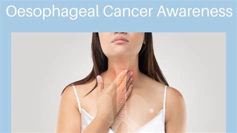 Oesophageal Cancer Risk Factors Symptoms Diagnosis Treatment