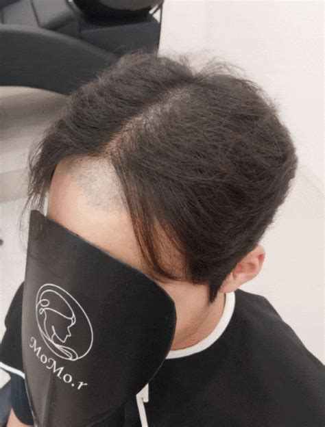 남자항암가발 돈 낭비하고 싶지 않다면 꼭 보세요 네이버 블로그