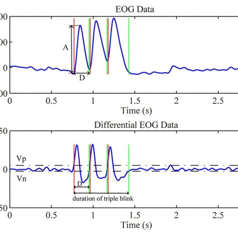 location of nine electrodes for eeg recording download scientific