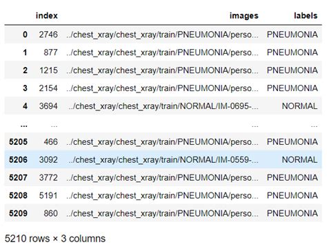 github abhijitgokhale pneumonia detection chest xray images using cnn