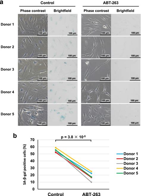 Senescence Associated Beta Galactosidase Sa β Gal Staining A Phase