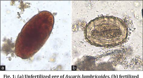 Ascaris Lumbricoides Life Cycle Pathogenesis Lab 50 Off