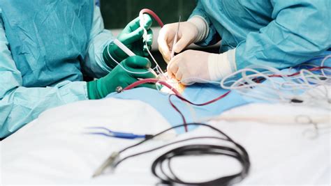 Извадиха 15 килограмов тумор от корема на пловдивчанин Информационна агенция ПИК