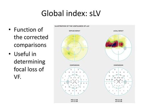 Interpretation Of Visual Fields With Special Reference To Octopus Pdf