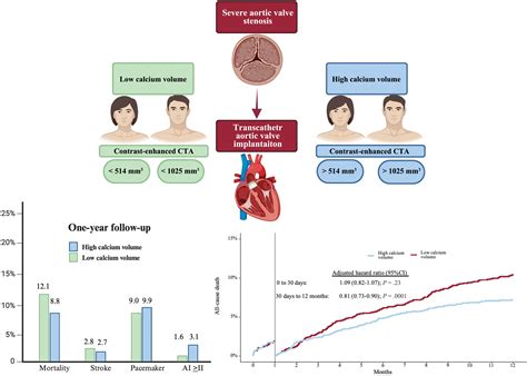 Aortic Valve Calcification Volume And Prognosis In Patients Undergoing