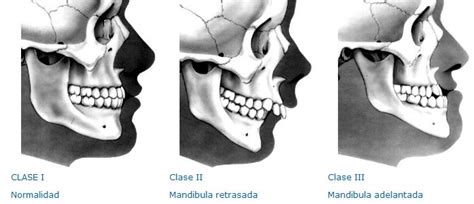 Qué Es La Articulación Temporomandibular O Atm Clínica Fivasa