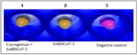 Detection Of Sars Cov 2 By The Rt Lamp Assay After Virus Binding To