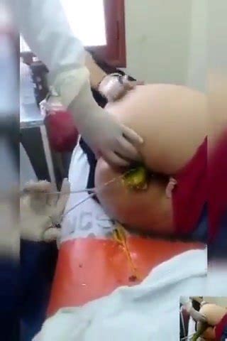 Doctors Remove Stuck Cucumber From An Tight Anus ThisVid Com