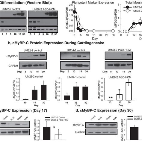 AdMYBPC3 Gene Transfer Prevents HCM Phenotype In Purified HESC CM