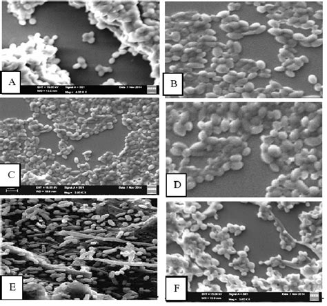Scanning Electron Microscopic Pictures Of The Different Isolate A