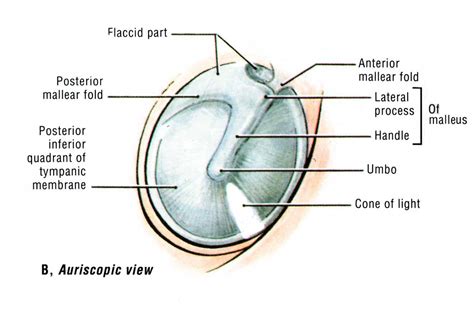 Temporal Bonetympanic Membrane Ranzcrpart1 Wiki Fandom Powered By