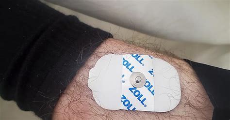 Ankle Patch Album On Imgur