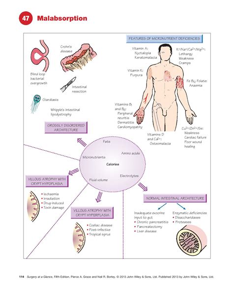 Malabsorption Symptoms Causes And Treatments