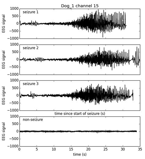Kaggle Seizure Detection