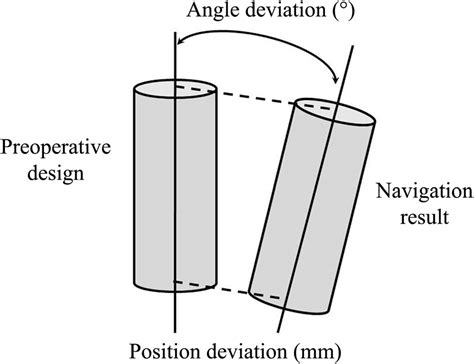 Sketch Map Of Deviation Measurement Download Scientific Diagram